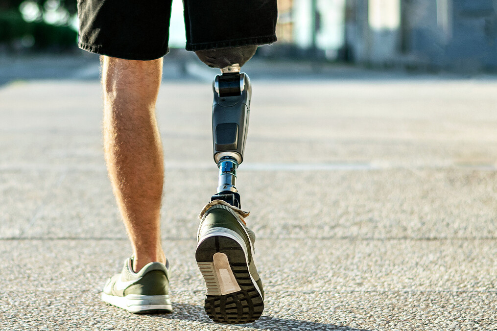 Amputation Rehabilitation - Pinnacle Vitality Rehab