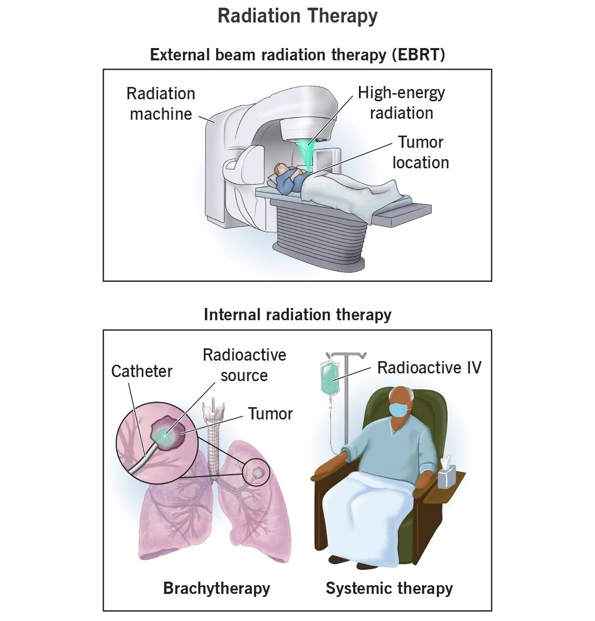 Study: Post-Radiation Therapy for Cancer Patients - Pinnacle Vitality Rehab