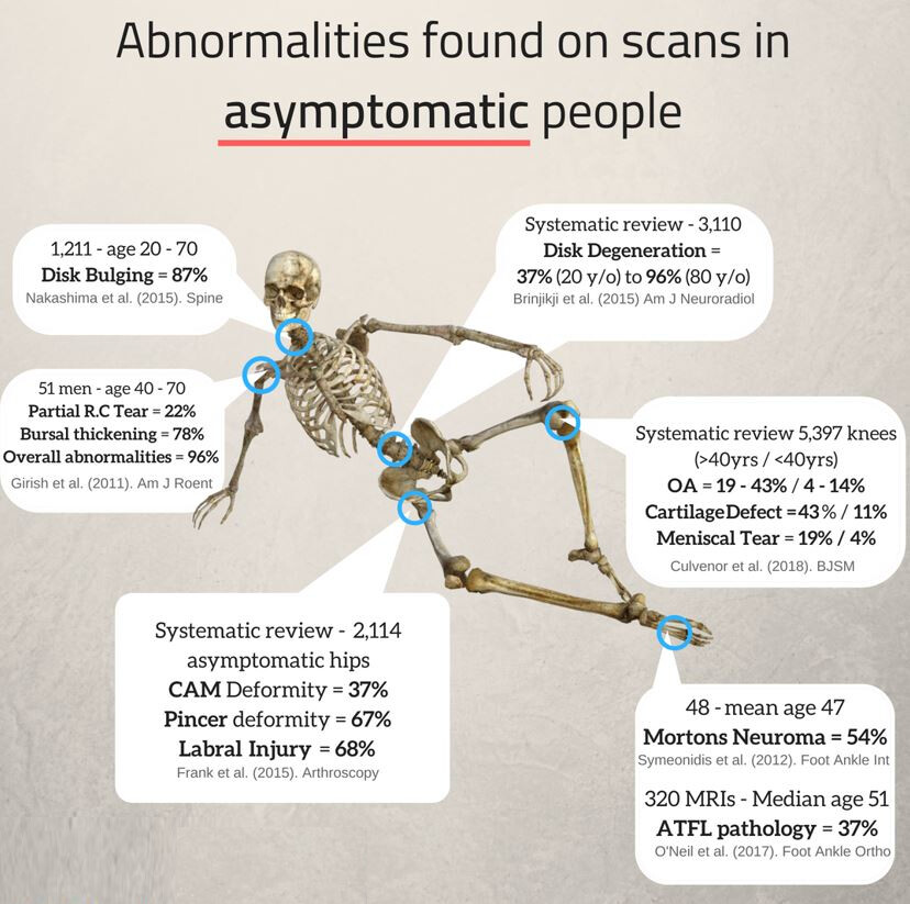 Abnormalities Found on Scans in Asymptomatic People - Pinnacle Vitality ...